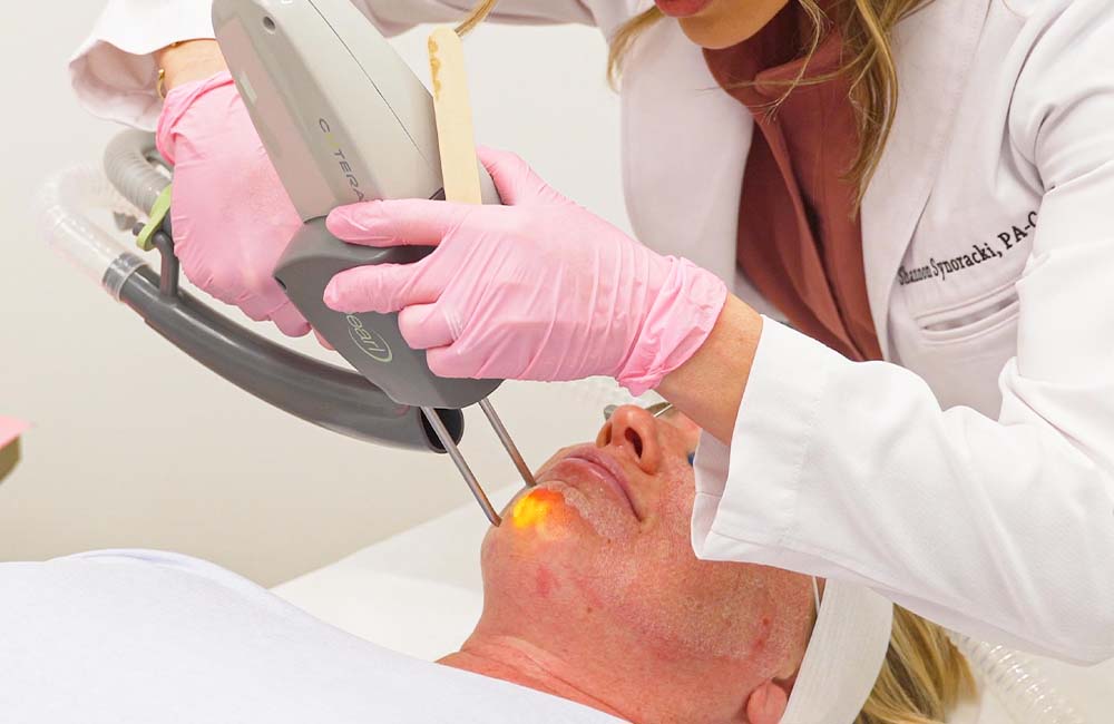 Laser Skin Resurfacing in Leesburg, VA | Prejuvenation Aesthetics